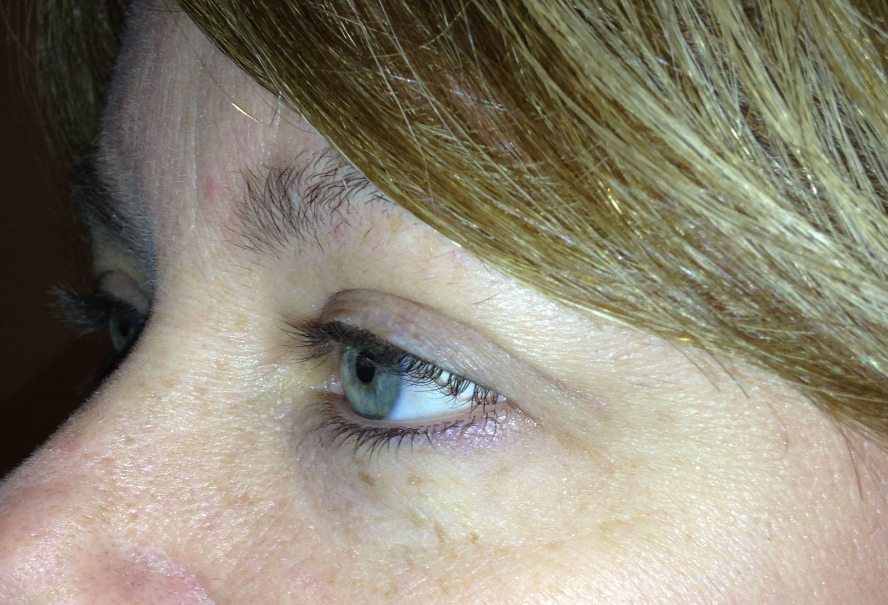 Justin A. Saunders, MD | Conditions