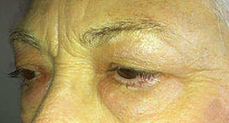 Justin A. Saunders, MD | Conditions