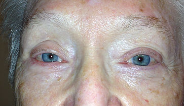 Justin A. Saunders, MD | Conditions