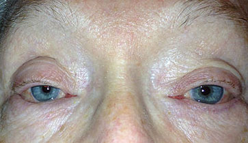 Justin A. Saunders, MD | Conditions