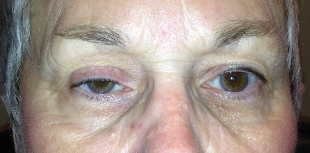 Justin A. Saunders, MD | Conditions