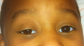 Justin A. Saunders, MD | Conditions