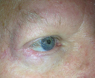 Justin A. Saunders, MD | Conditions