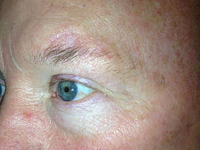 Justin A. Saunders, MD | Conditions