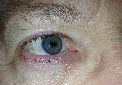 Justin A. Saunders, MD | Conditions